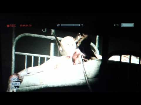 Əlini Kesdiler | Outlast Bolum 7