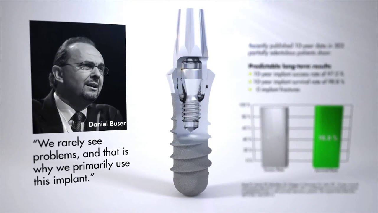 Straumann Soft Tissue Level System Time Tested - YouTube