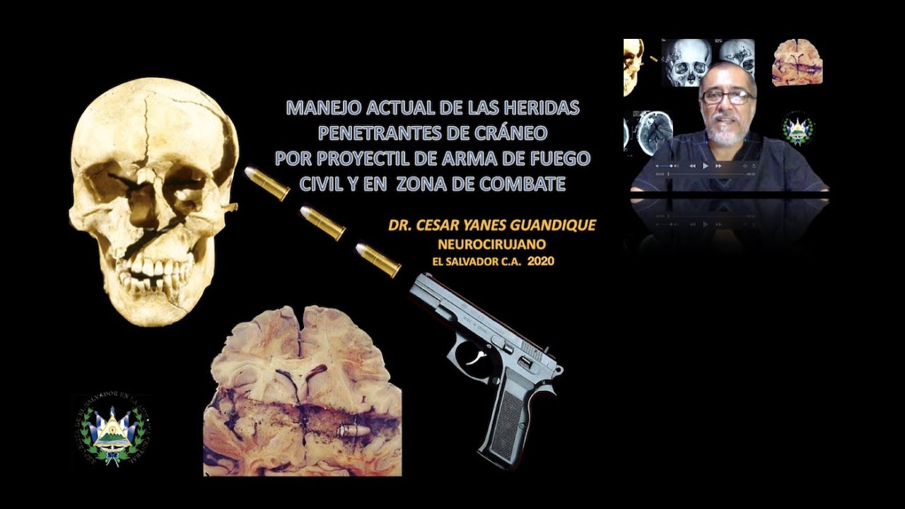 "MANEJO ACTUAL DE LAS HERIDAS PENETRANTES DE CRANEO POR PROYECTIL DE ...
