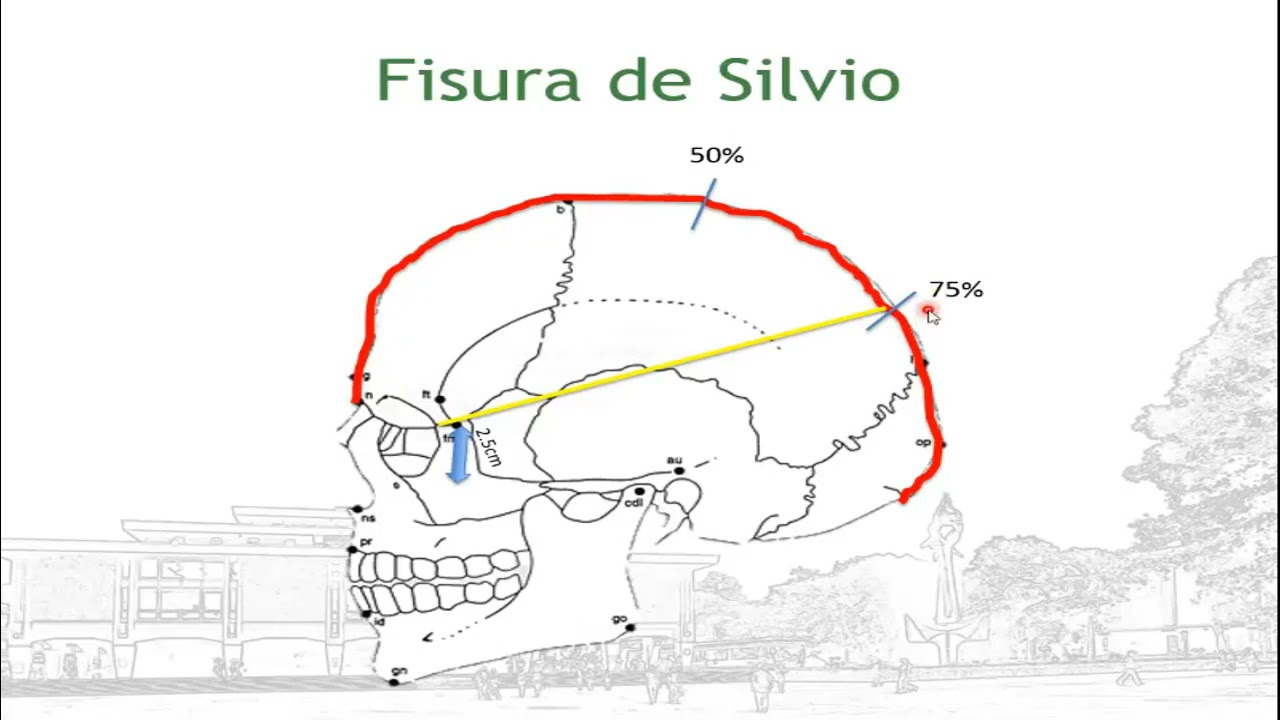Craneometría y anatomía ósea de la base del cráneo - YouTube