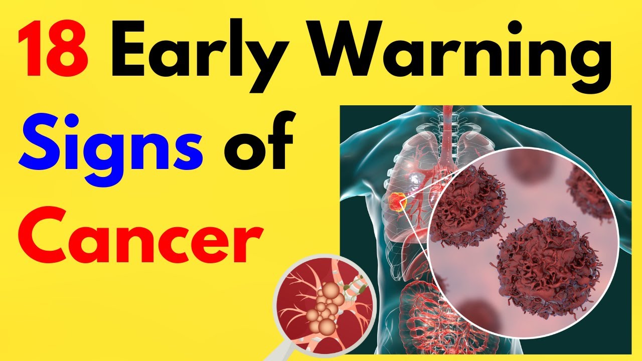 18 Early Warning Signs of Cancer | #cancer #sign #health - YouTube