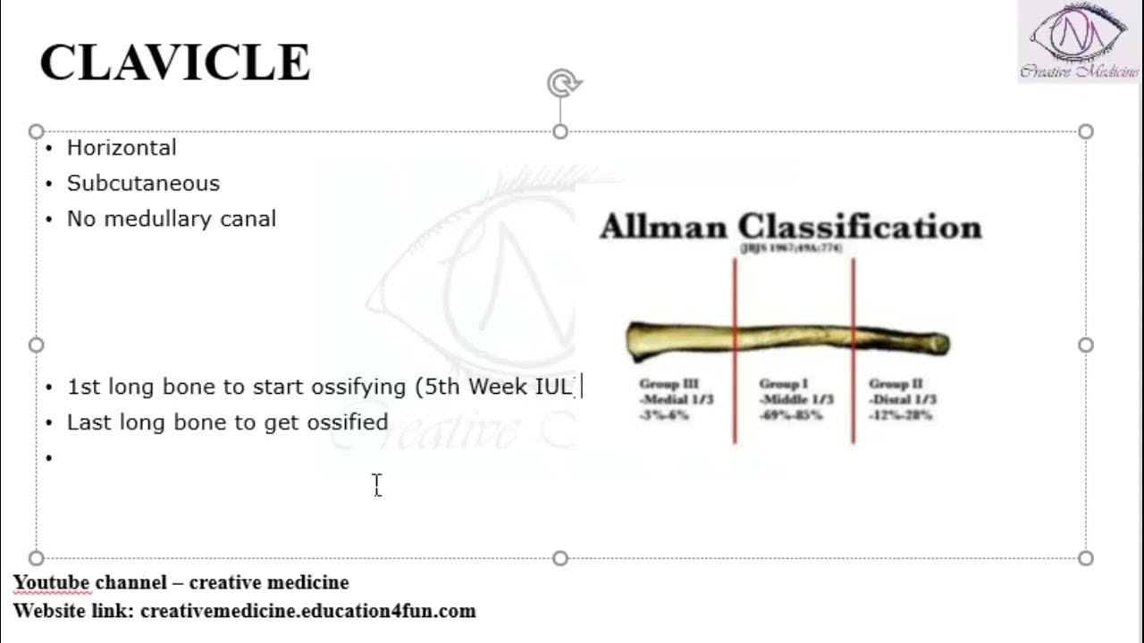 Lec 2 CLAVICLE Allman Classification mp4 || ORTHOPEDICS - YouTube