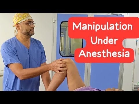 Manipulation under Anesthesia MUA | Dr. Prateek Joshi #mua #knee # ...