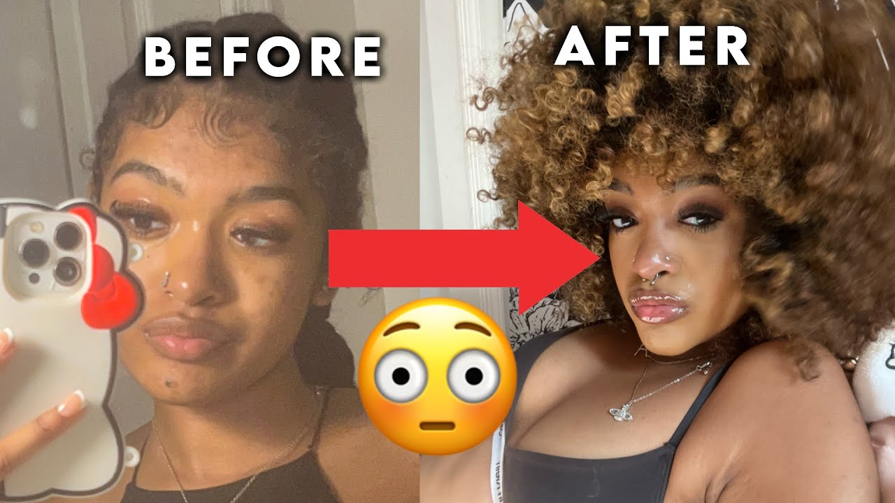 Relatable Makeup Tutorial Ft Acne Scars , Hyperpigmentation, And A Bad ...