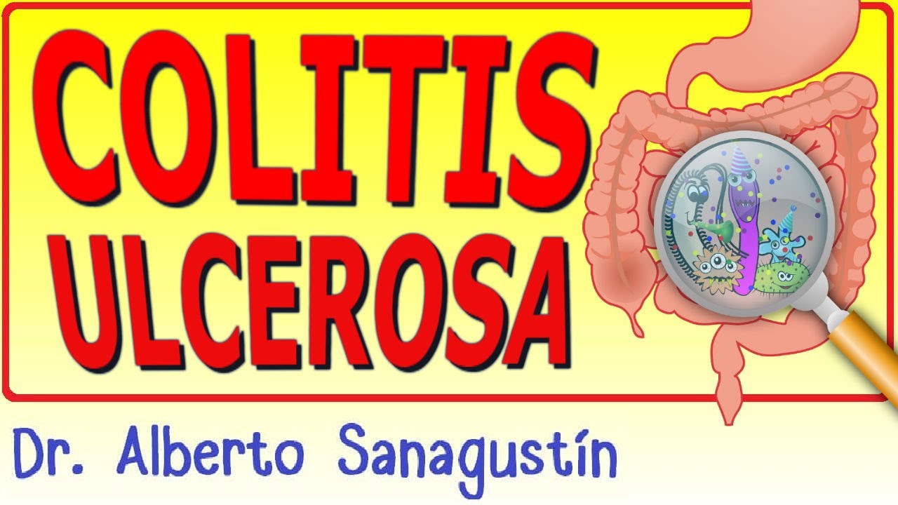 COLITIS ULCEROSA (explicada fácil) - YouTube