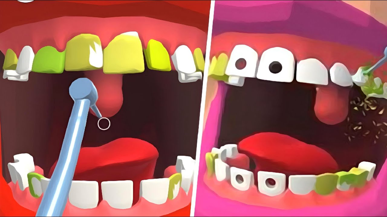 Dentist bling - Teeth clinic games - YouTube