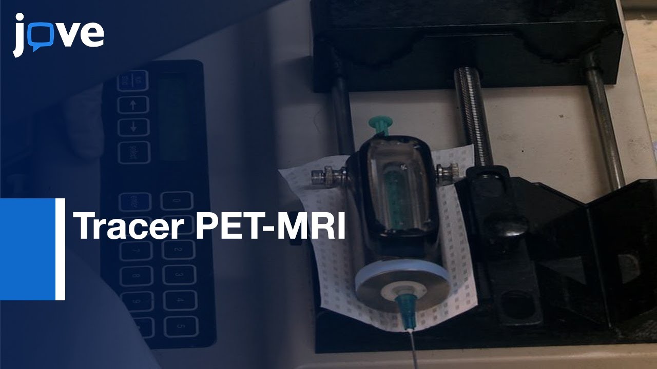 Tracer PET-MRI protocol to measure Brain Energy Substrates Uptake ...