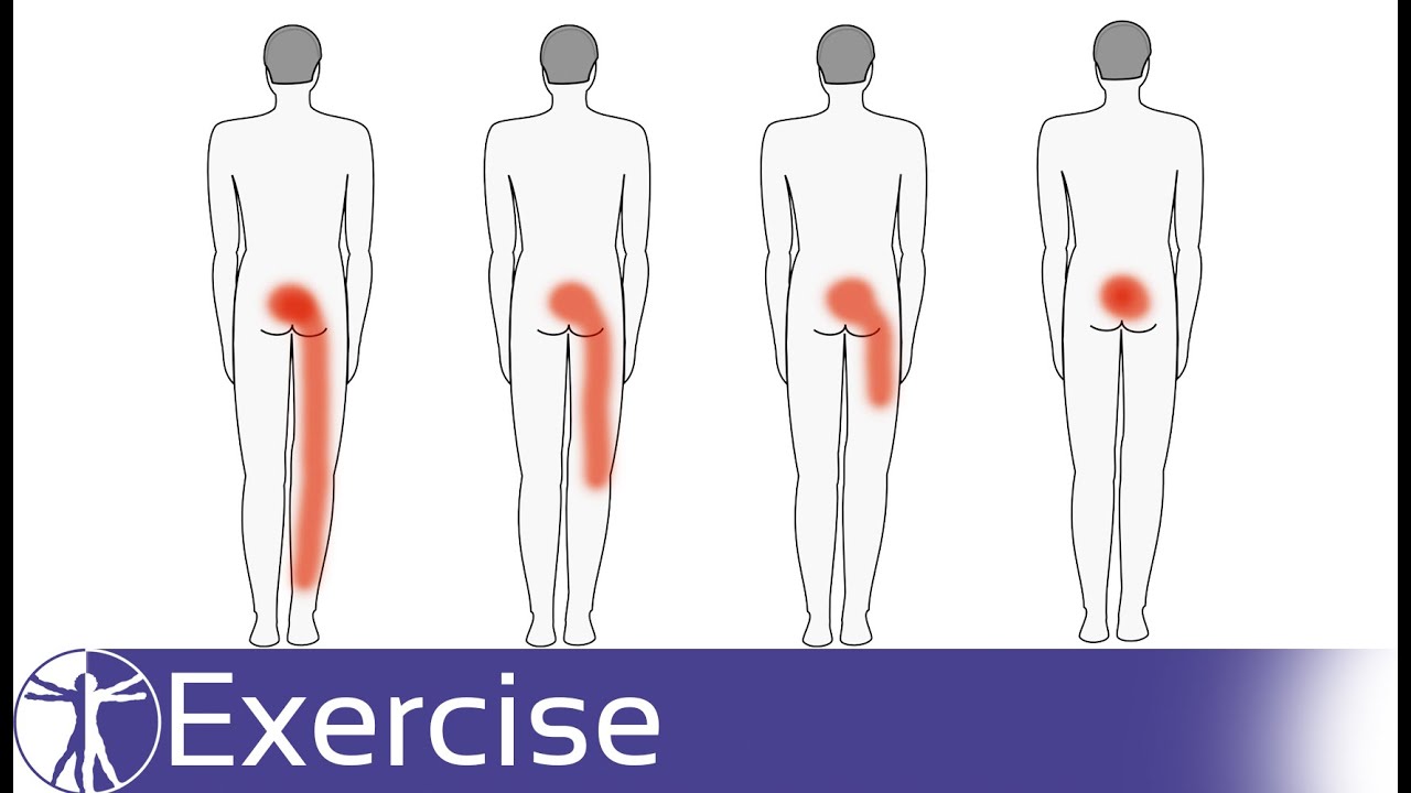 Direction Specific Exercises for Low Back Pain | Directional Preference - YouTube