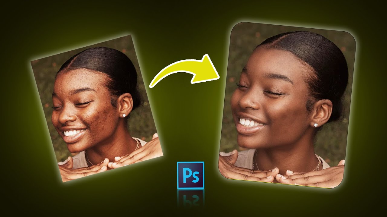 ጥርት ያለ ቆዳ በፎቶሾፕ | Clear Skin in Photoshop | Pimple Removal Tutorial ...