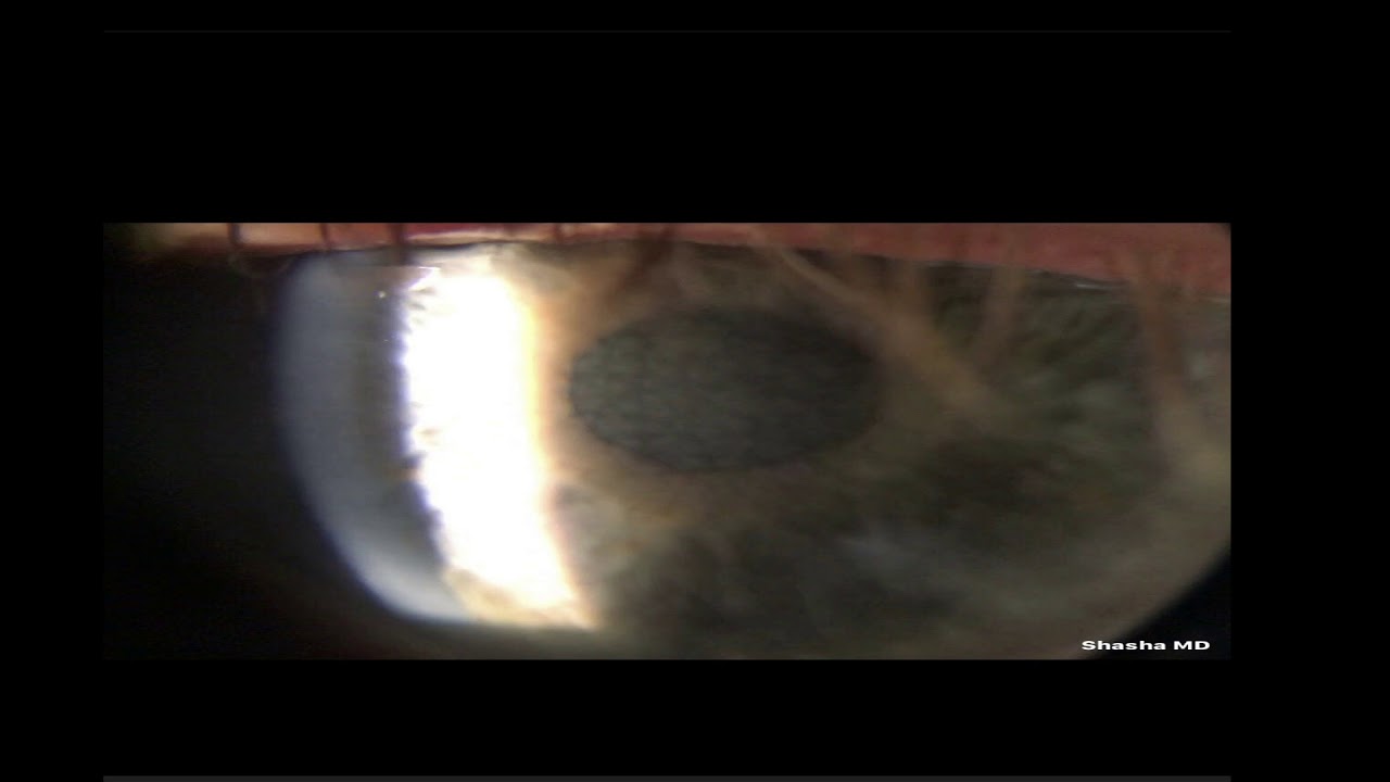 Crocodile Shagreen - YouTube