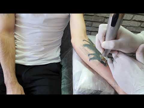 Tattoo romeval