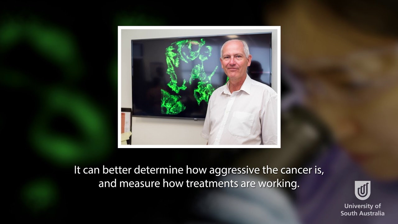 Professor Doug Brooks - UniSA’s Fight Against Cancer - YouTube
