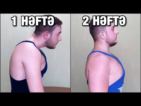 4 SADƏ HƏRƏKƏTLƏ BELİNİZİ DÜZƏLDİN ! KİFOZ \