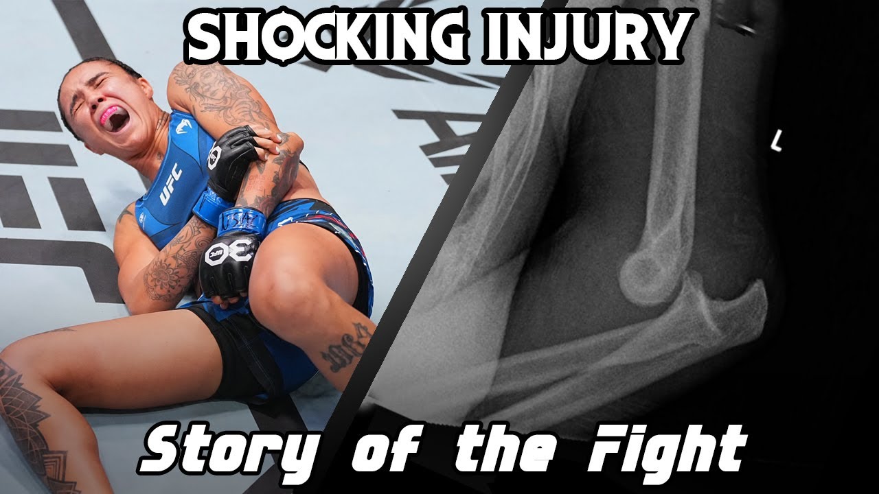 Nasty UFC Arm Break!!! | Istela Nunes vs Viktoriya Dudakova Full Fight ...