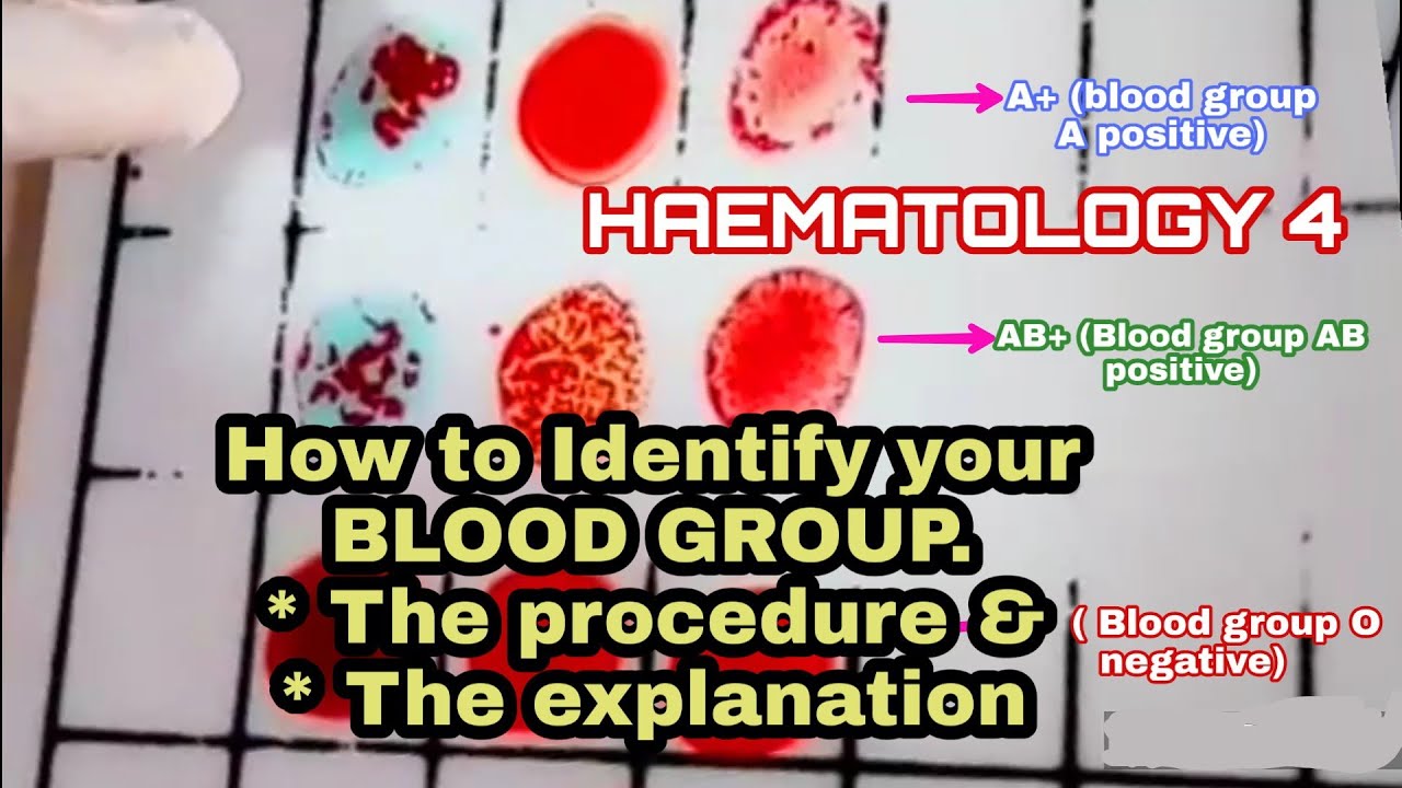 HAEM 4.HOW to TEST YOUR BLOOD GROUP.Simple and easy - YouTube