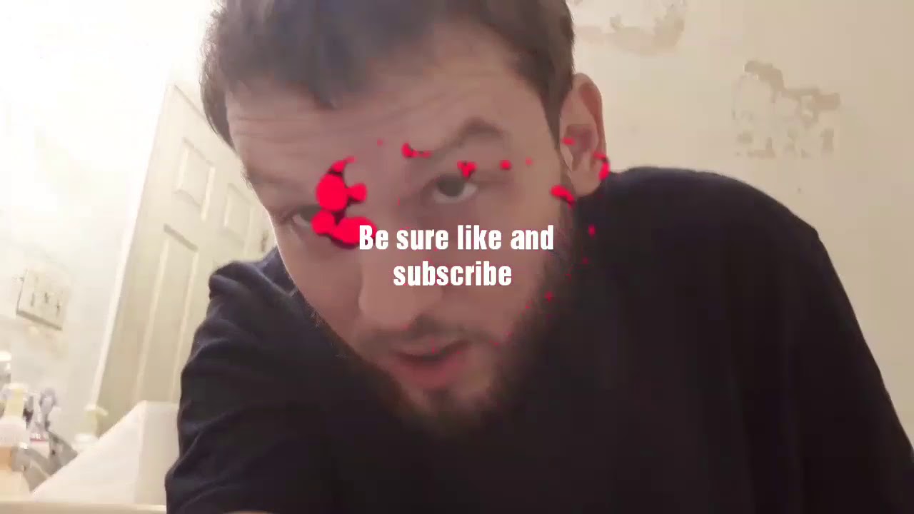 Poop Cam Vlog Ep 107 I'm Constipated I Got Dingleberries - YouTube