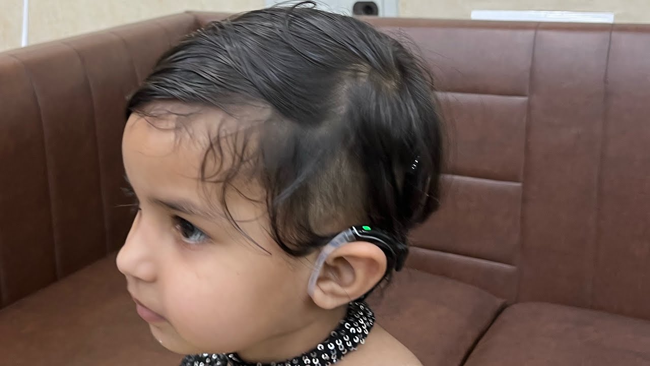 Cochlear Implant Switch on both ears| Best Cochlear Implant Clinic in ...