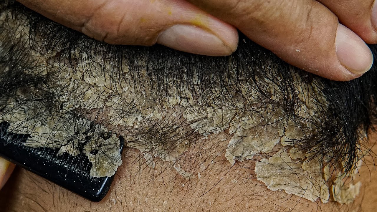 Ultimate Relaxation with Comb #DKMO3301 - YouTube