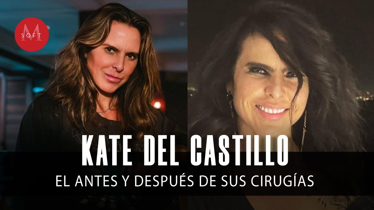 Kate del Castillo y las CIRUGÍAS a los que se ha sometido - YouTube