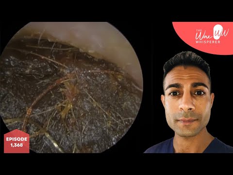 Does Ear Wax Repel Insects