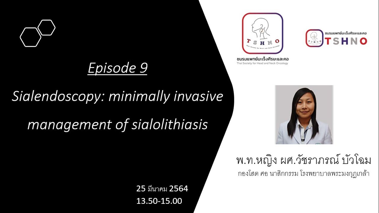 Ep 9 : Sialendoscopy: minimally invasive management of sialolithiasis ...