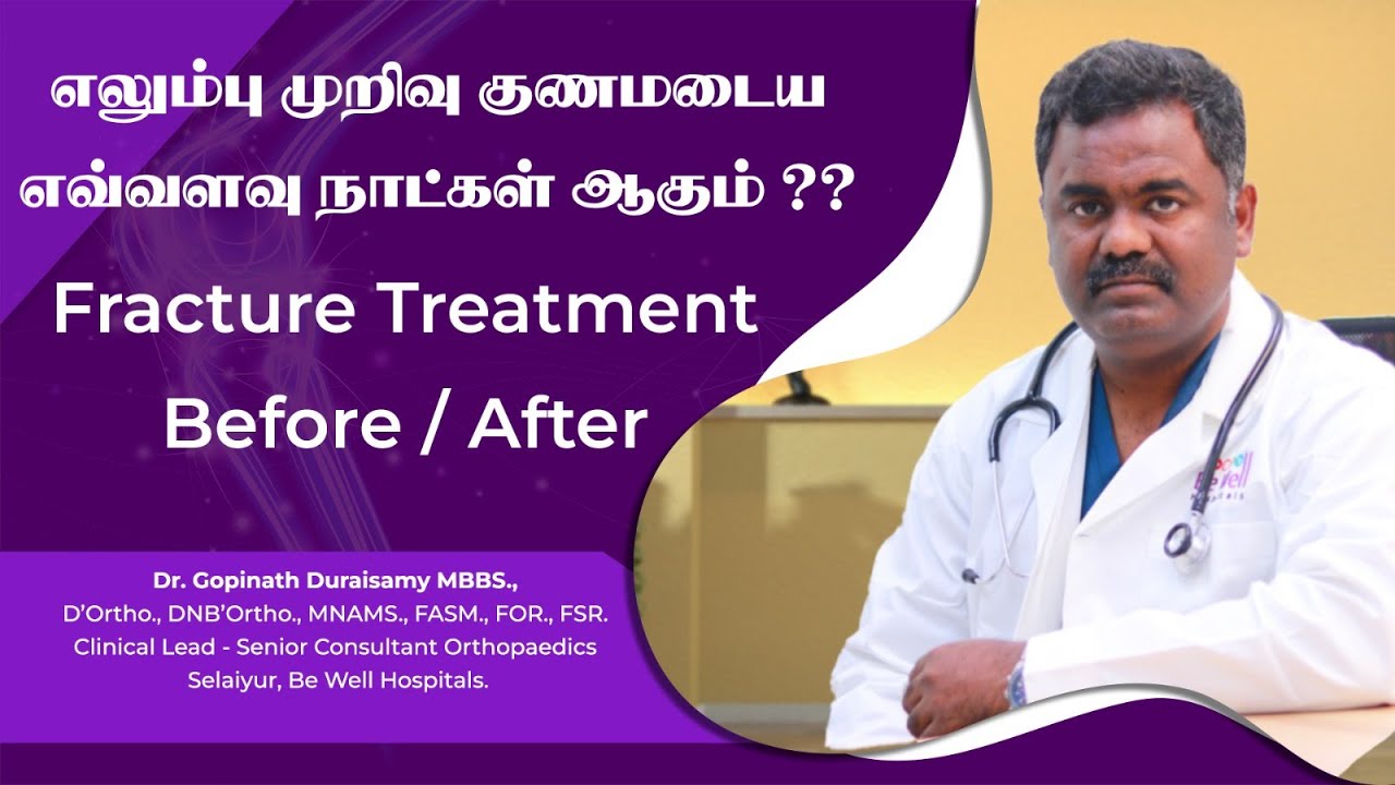 Fracture Treatment Before and After Surgery Explained By Be Well ...