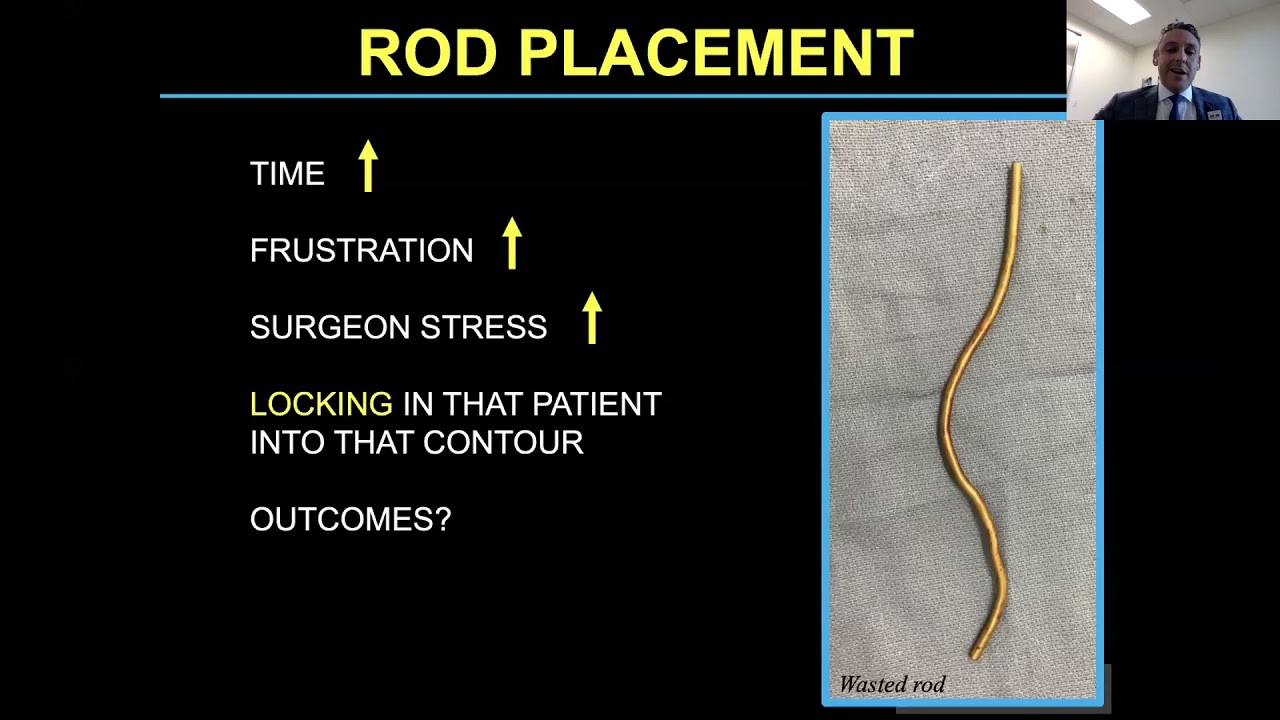 Lecture: Incorporating Patient Specific Rods Into Your Spine Practice ...
