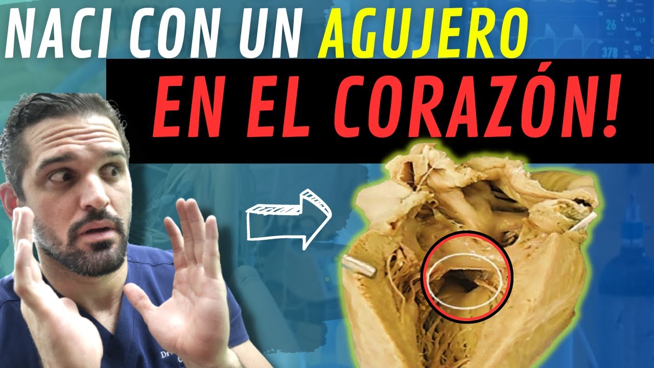 DESCUBRIENDO los DEFECTOS cardíacos congénitos y CUANDO tratarlos - YouTube
