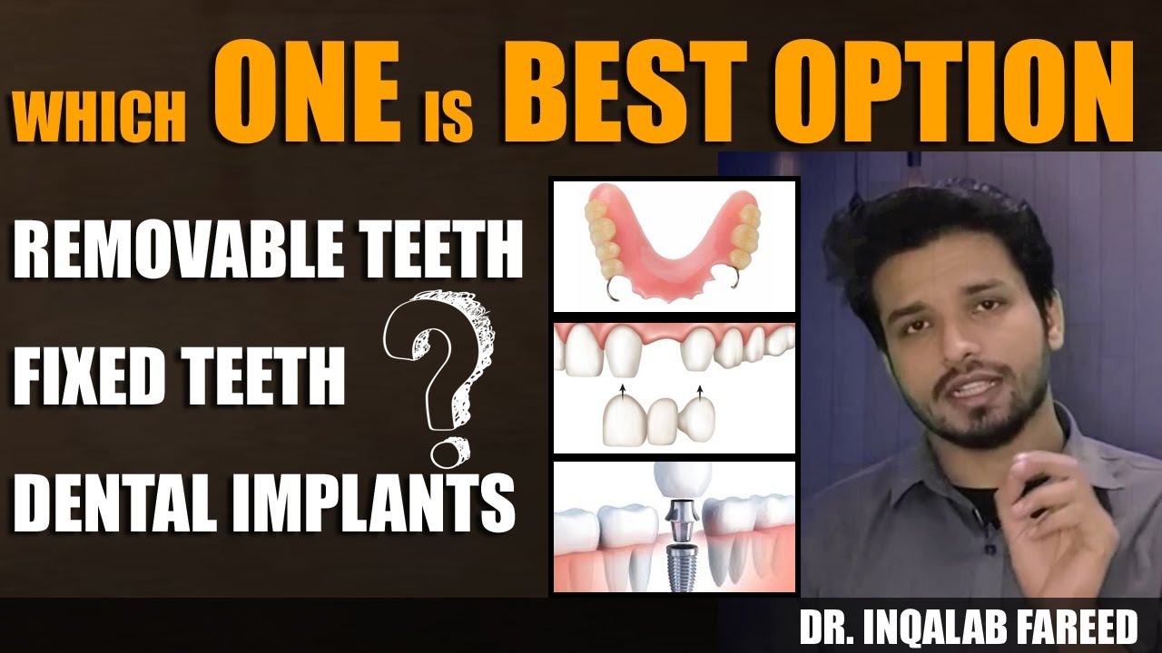 What are Artificial Teeth Replacement Options? | Removable Teeth ...