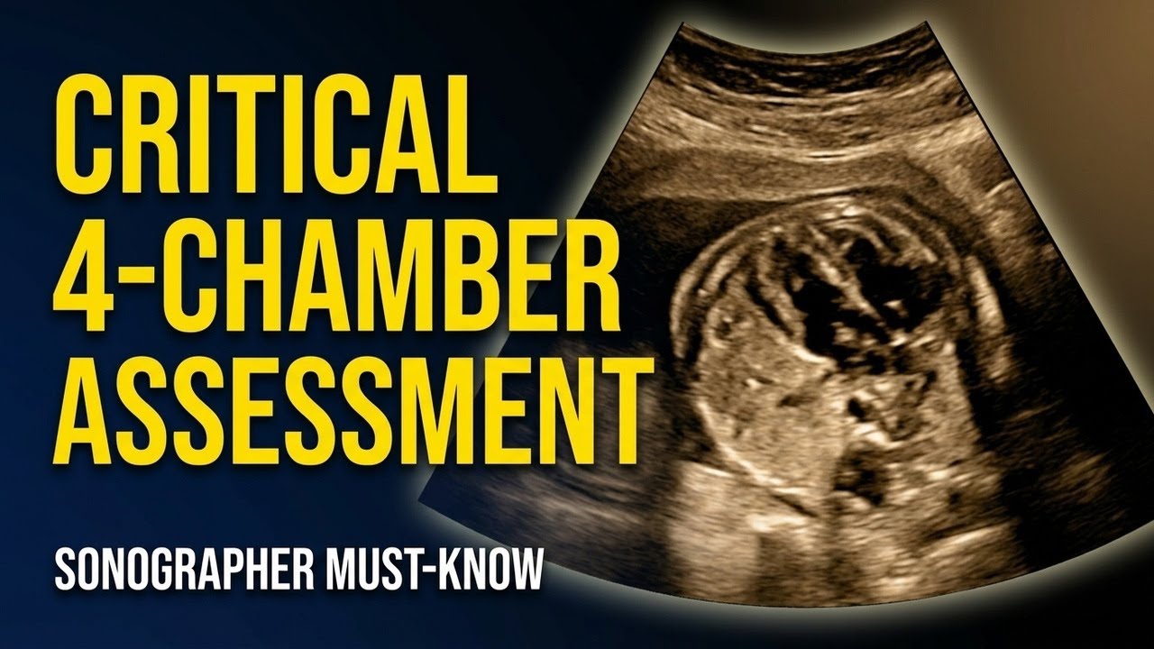 The Critical 4-Chamber View Assessment Every Sonographer Needs - YouTube