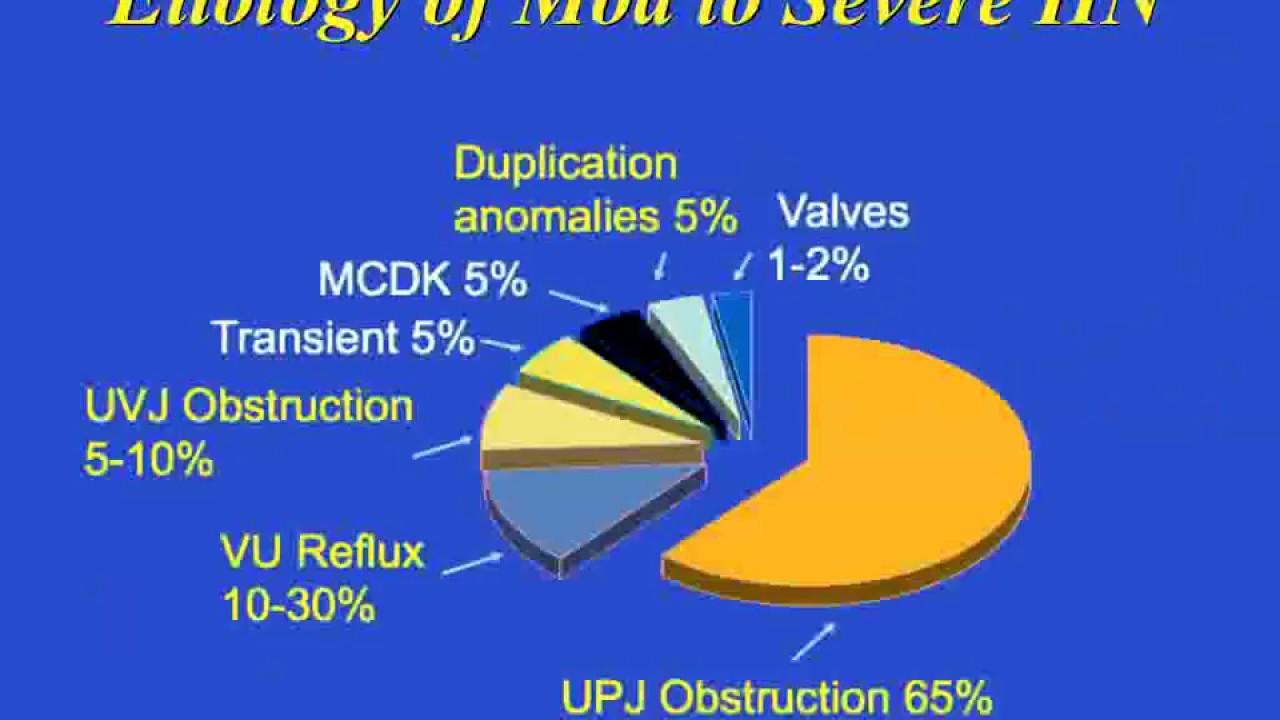 Magnetic Resonance Urography in Congenital Urological Disorders - YouTube