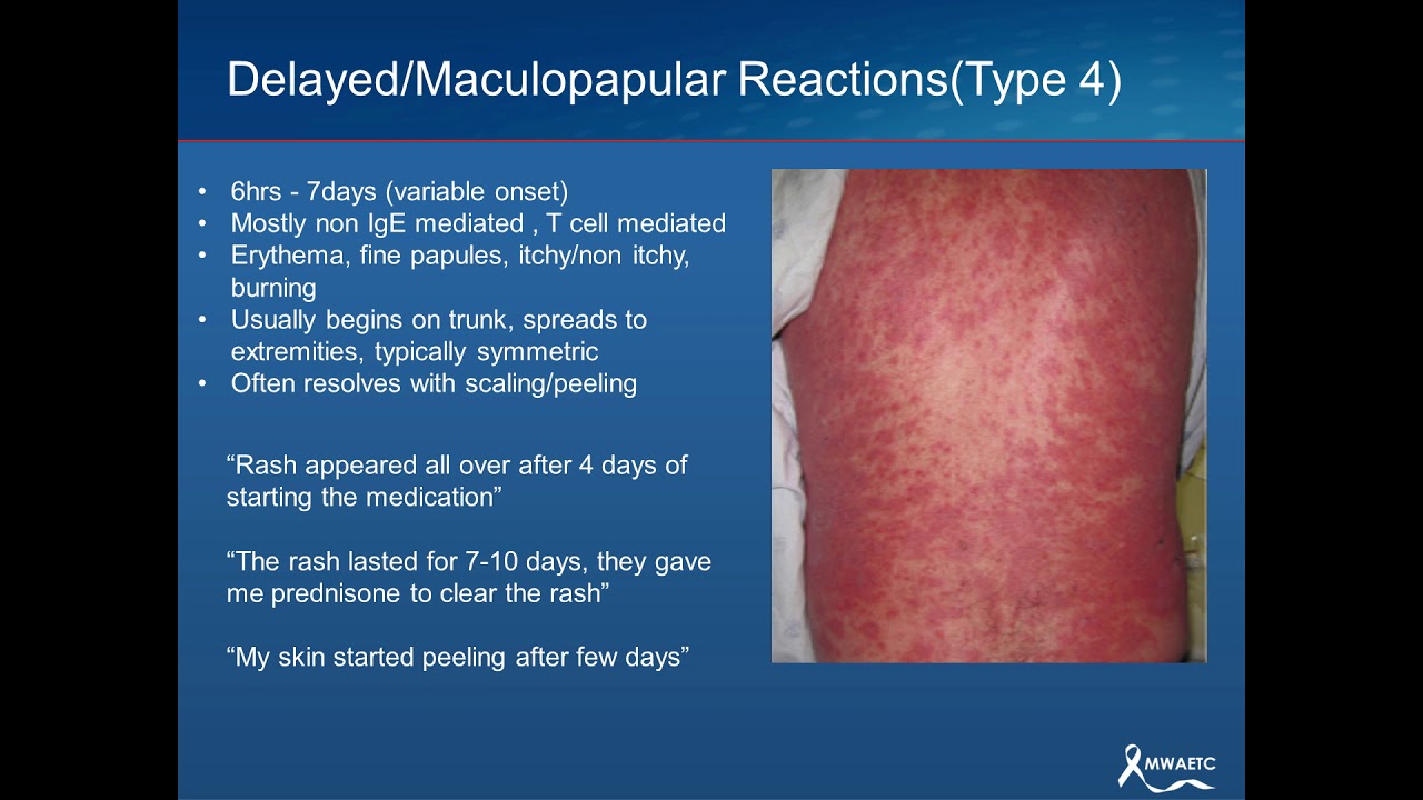 Beta-lactam Allergies in Persons with HIV - YouTube