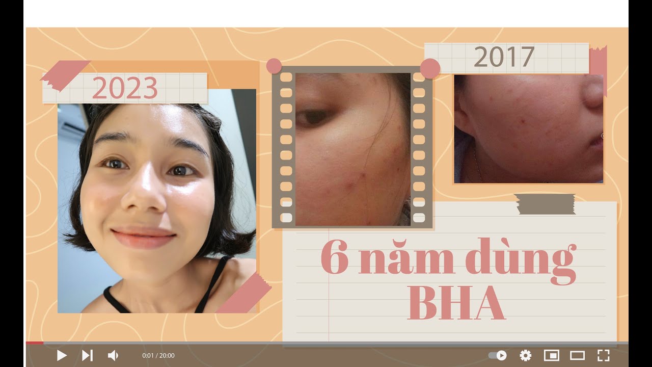bha - bha Obagi hay bha Paula's choice - bha trị mụn đầu đen - Tờ Hi Skincare - YouTube