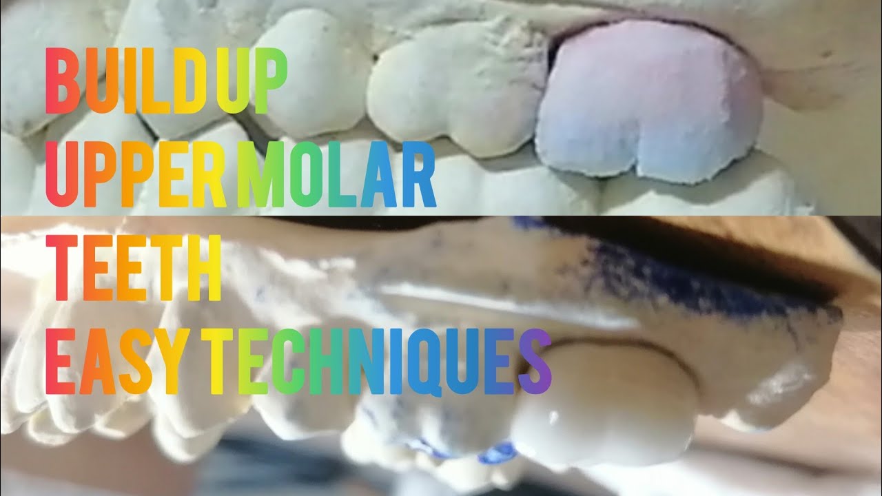 build up Molar Teeth easy style.. (porcelain crown) - YouTube