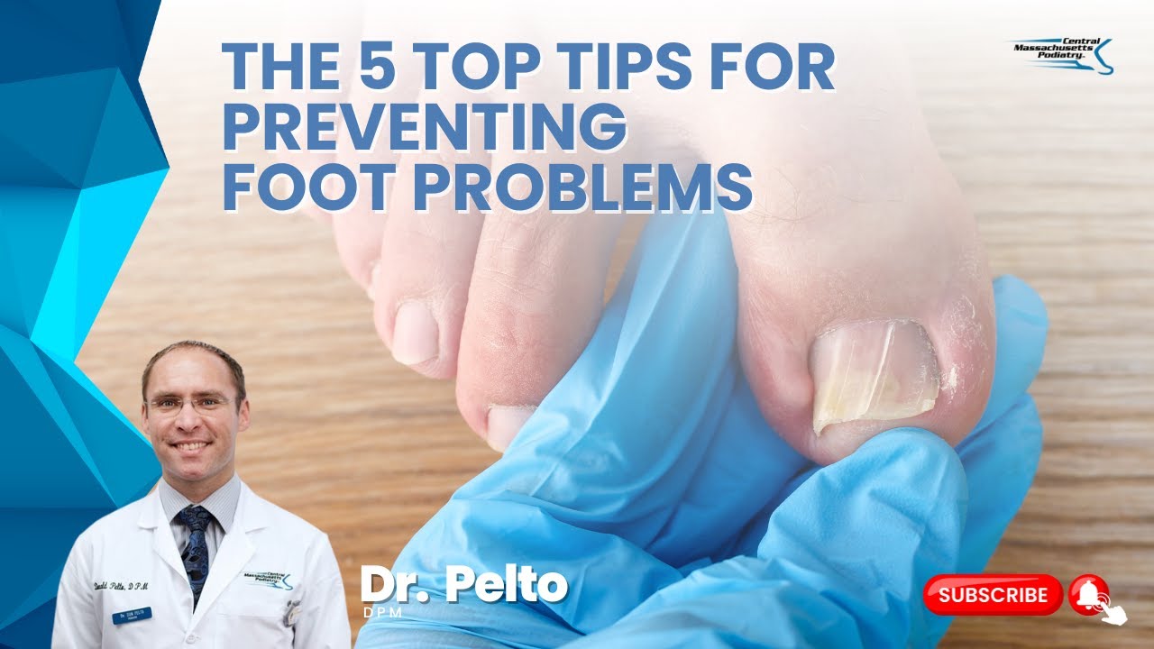 5 TOP TIPS for preventing common foot problems - YouTube