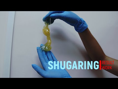 What does the result of depilation with sugar paste look like? Shugaring