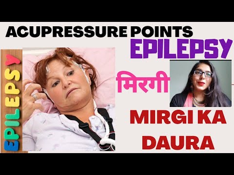 मिरगी / EPILEPSY / MIRGI KA DAURA ACUPRESSURE POINTS 🙂 - YouTube