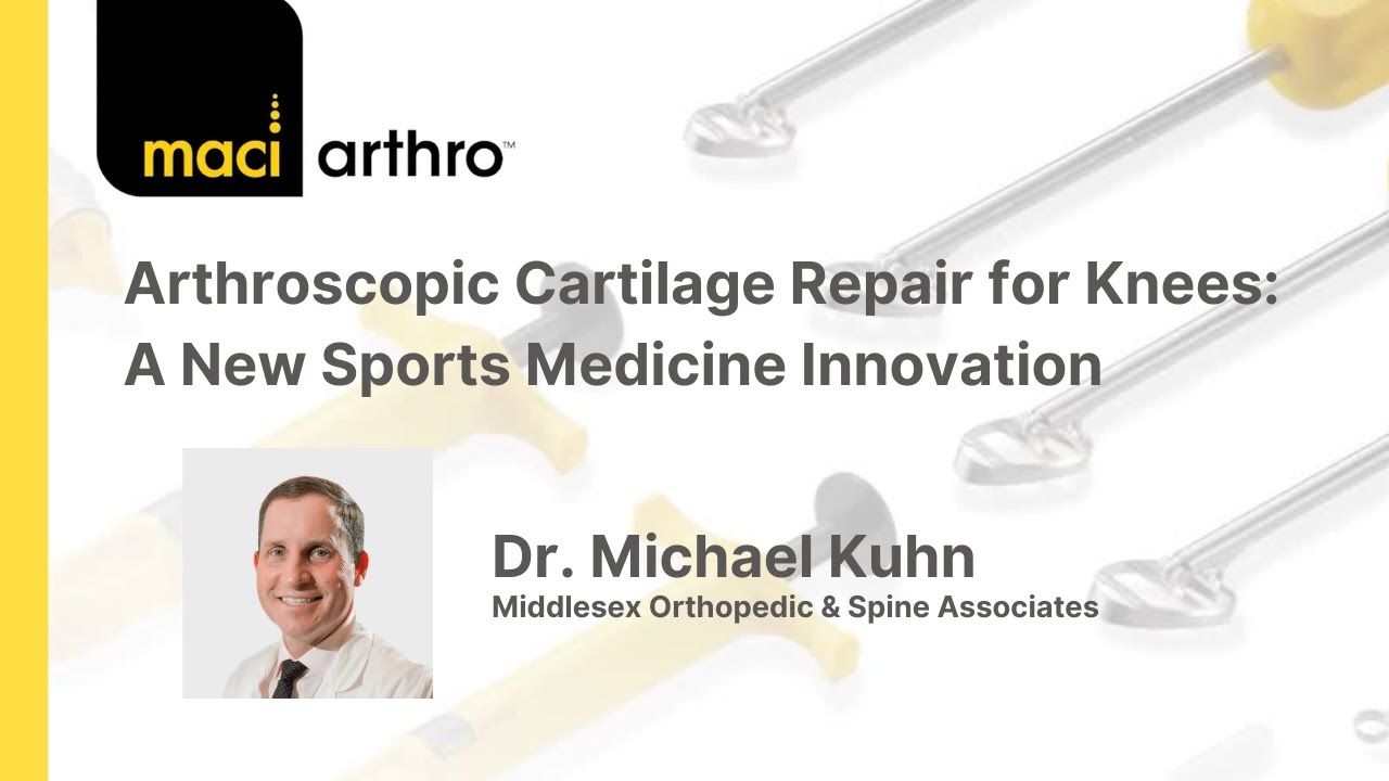 Arthroscopic Cartilage Repair for Knees: A New Sports Medicine ...