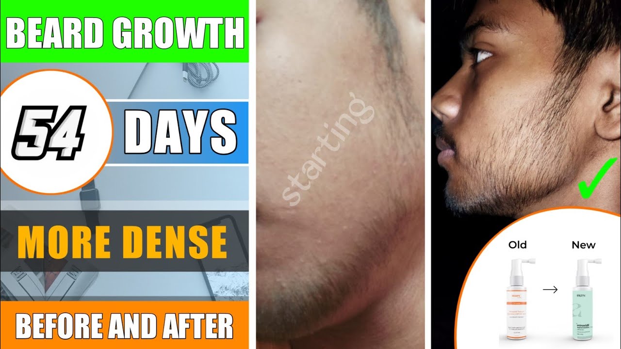 BEARD GROWTH IN 54 DAYS (more dense) BEFORE AND AFTER || Beard growth ...