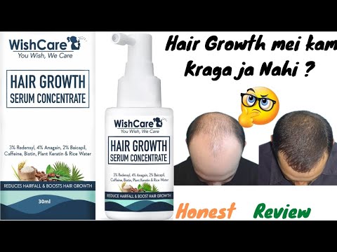 Wish care hair growth serum review - YouTube