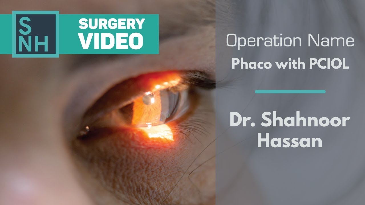 Phaco With PCIOL - YouTube