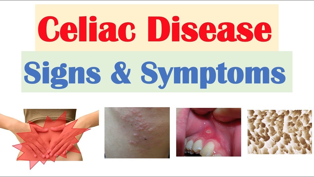 சிலியாக் நோய் பற்றி | Celiac Disease Signs & Symptoms | Nutrient ...