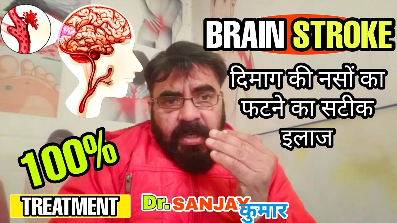 Brain Stroke Ka Ilaj Brain Stroke In Hindi Dimag Ki Naso Ka Fatna brain-stroke-ka-ilaj-brain-stroke-in-hindi-dimag-ki-naso-ka-fatna