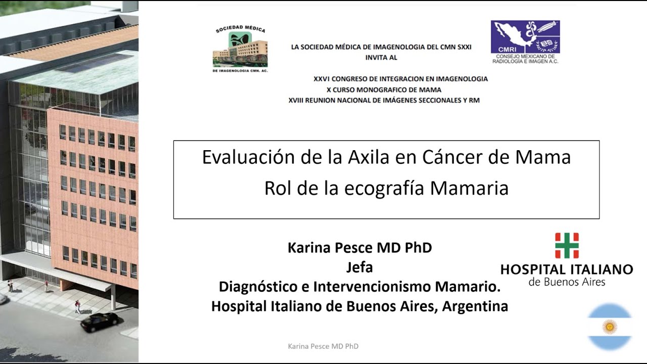 2 - 5 Evaluación de la axila en cáncer de mama | Dra. Pesce - YouTube