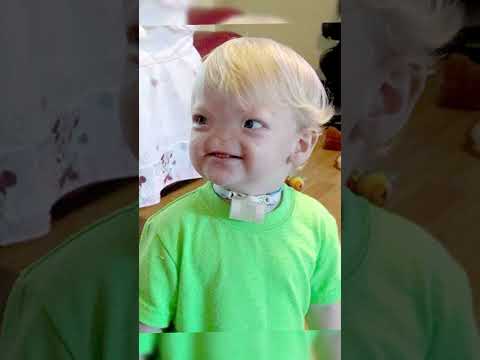 AS PESSOAS MAIS RARAS DO MUNDO! PT.1 😮🤗 #shorts #youtubeshorts #youtube