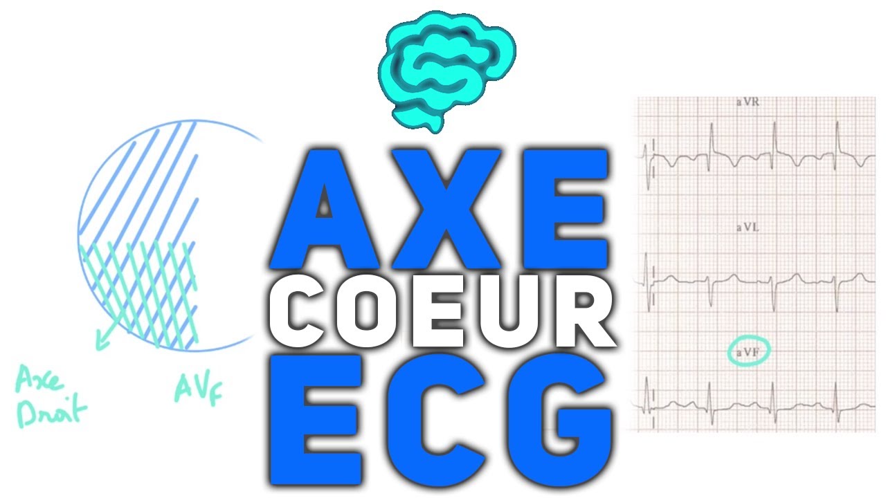 🔴 L' Axe du Coeur ECG Expliqué Très Clairement par Dr Astuce - YouTube