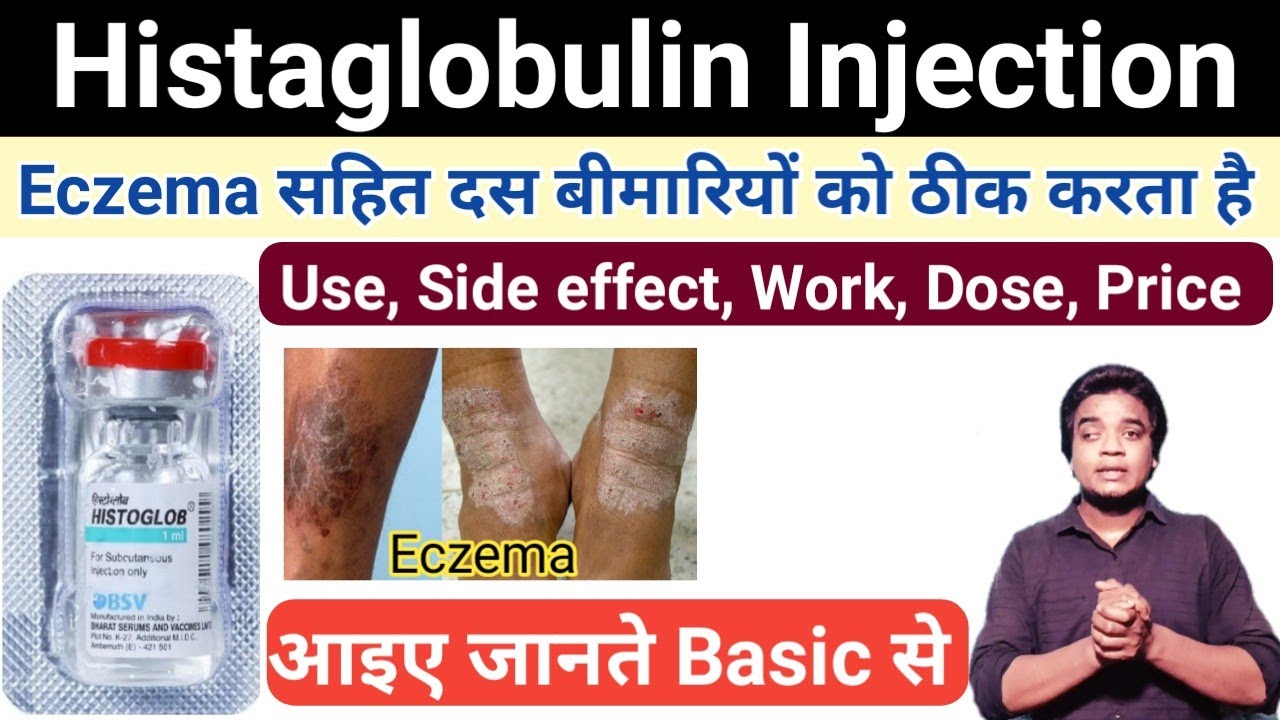 Histaglob Injection 1 ml Use || Histaglobulin injection ke fayde Eczema ...