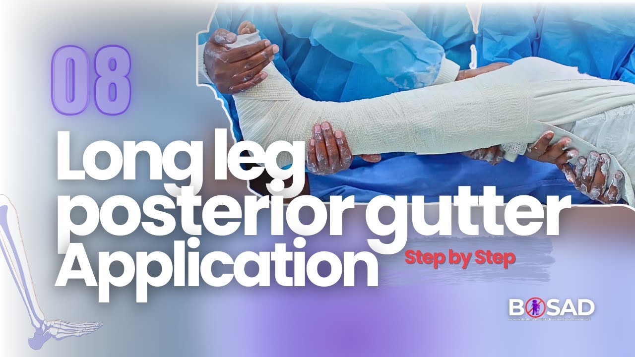 Lesson 08: Long Leg Posterior Gutter Application | ከጉልበት በላይ የኋላ መደገፊያ ...