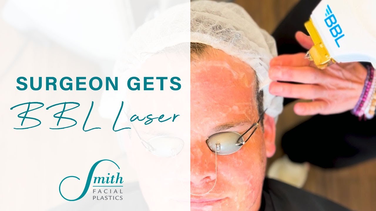 Facial Plastic Surgeon Gets BBL Laser Treatment! - YouTube