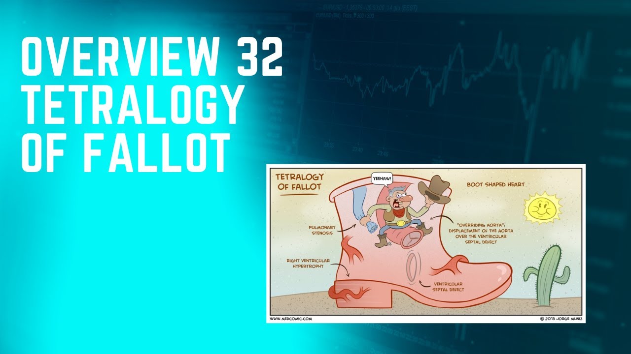 Overview 32 : Tetralogy of Fallot - YouTube